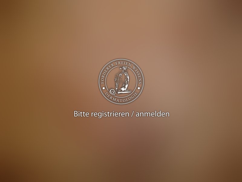 Narben, hypertrophe/Keloide - Wikiderm.de